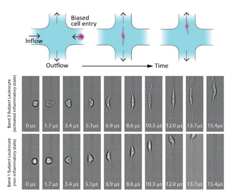 Deformability Cytometry: A Revolution in Sepsis Detection - Cytovale